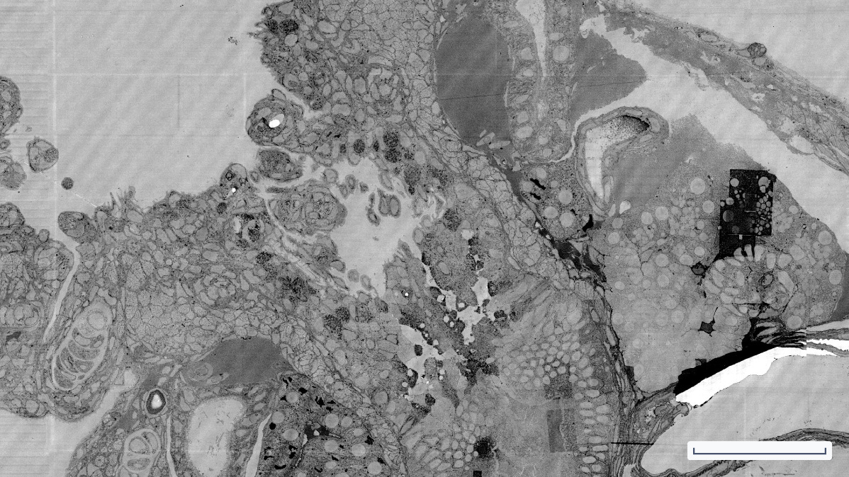 FAST-EM | Ultra-fast automated multibeam electron microscope